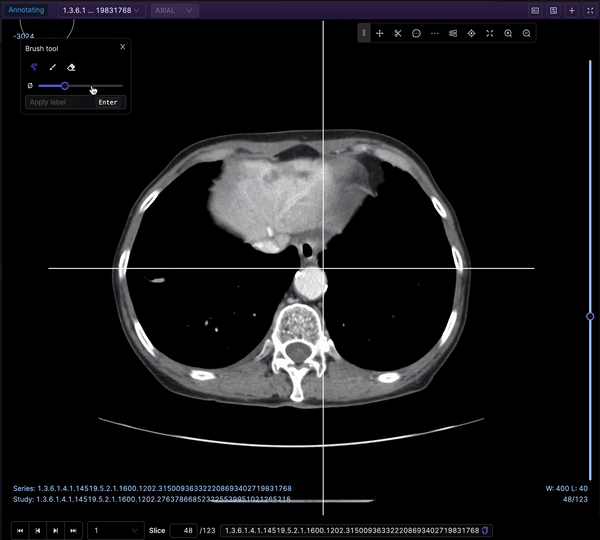 DICOM Updates [May 2023] | Encord