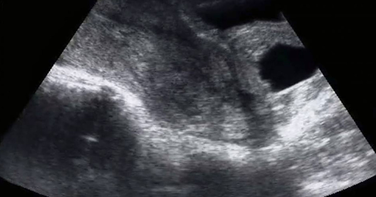 Woman's viral Facebook post gives others courage to speak out about ...