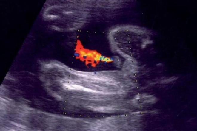 Week-by-week pregnancy scan photos - Netmums