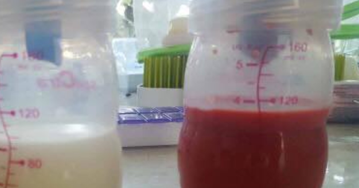 Mum Shares Photo Of Bloody Breast Milk That’s ‘Safe To Drink’ - Netmums