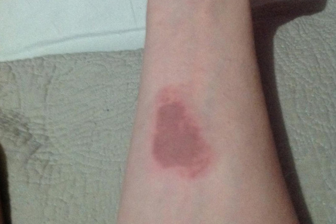 NSPCC warns parents about ‘Salt and Ice Challenge’ dangers - Netmums