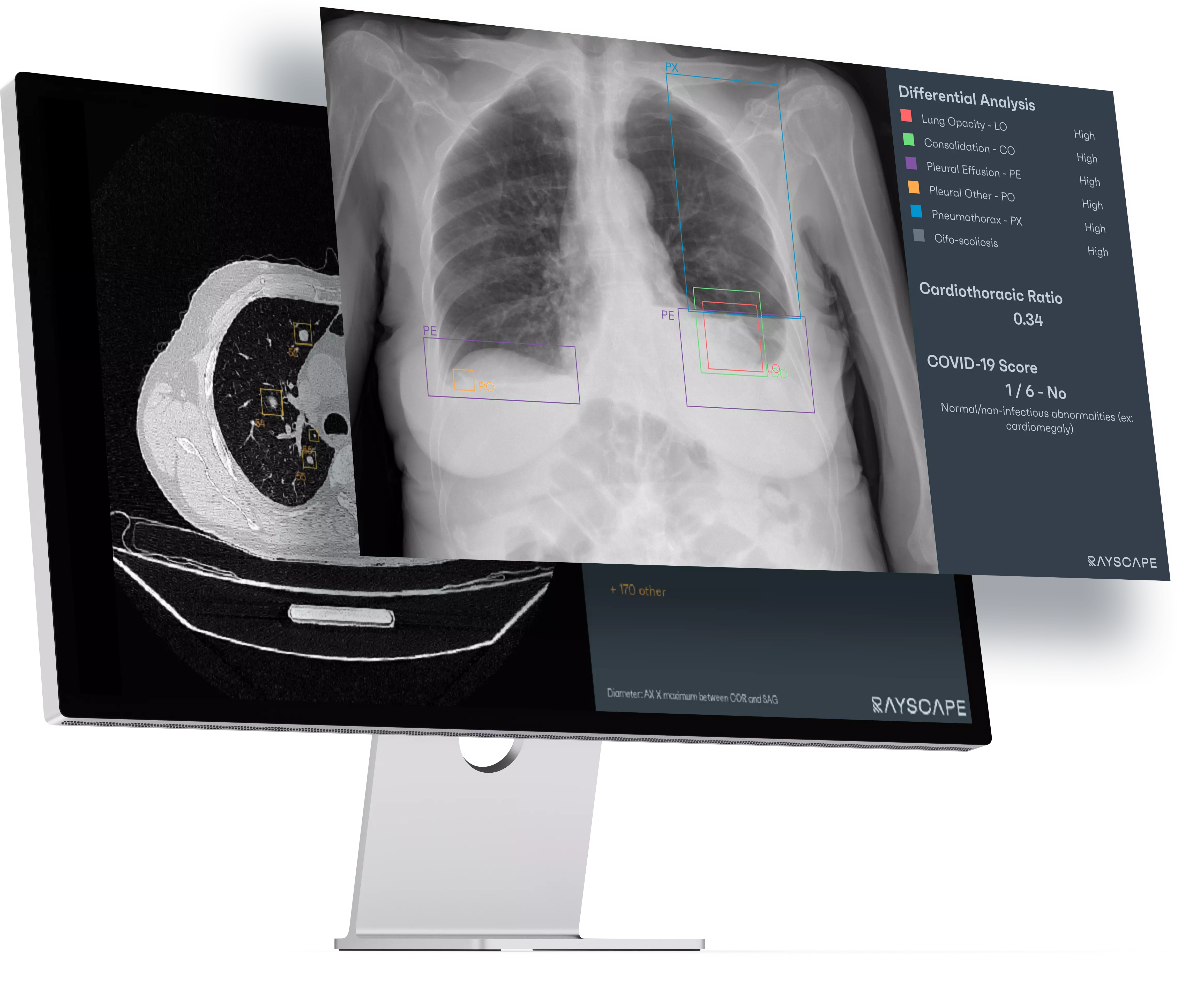 Rayscape | Radiology AI